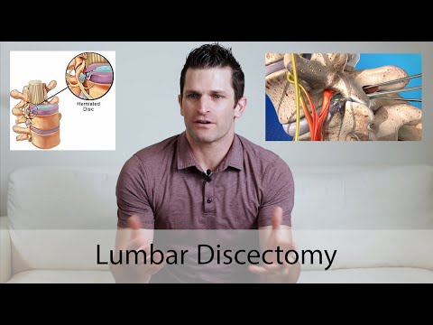Lumbar Discectomy surgery