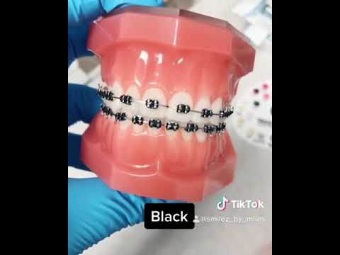Top 5 Colors for Braces!! Whiter teeth 😁