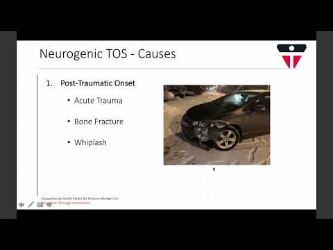 RSI Day 2022 Week 1 – Thoracic Outlet Syndrome