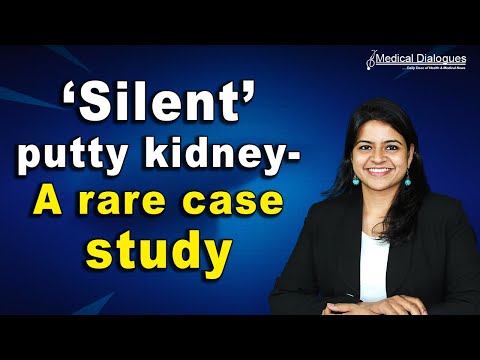 ‘Silent’ putty kidney- A rare case study