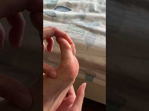 Test for Sesamoiditis - Passive Axial Compression Test