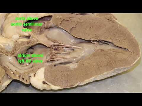 chordae tendineae