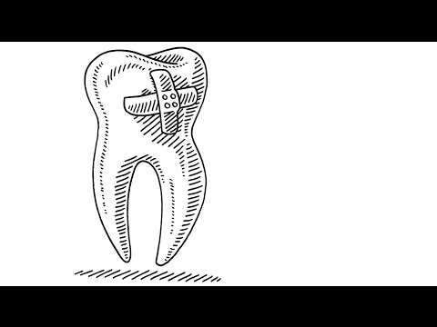 What it means when you dream about your teeth falling out