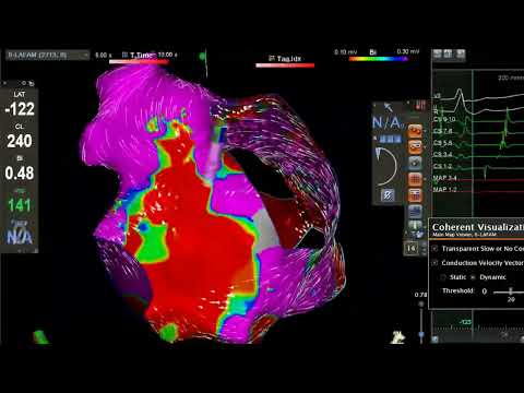 Atypical Flutter