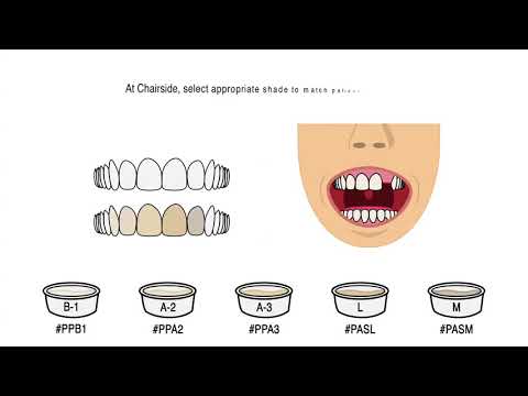 PERFECT A SMILE ALIGNER PONTIC PAINT - AB Orthodontics