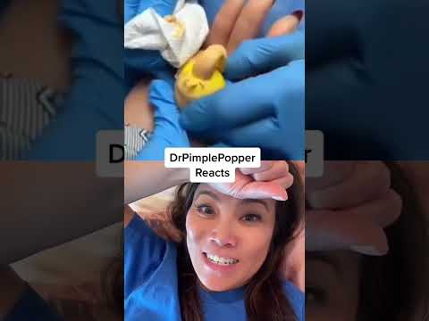The Grossest Hand I Have Reacted to on Tiktok #shorts
