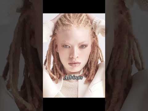 Types of Black People pt1. #viral#shorts#short#trending#albino#albinism #blm#blackhistorymonth#black