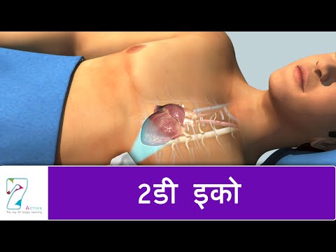 2 डी इको | 2D Echo | Hindi