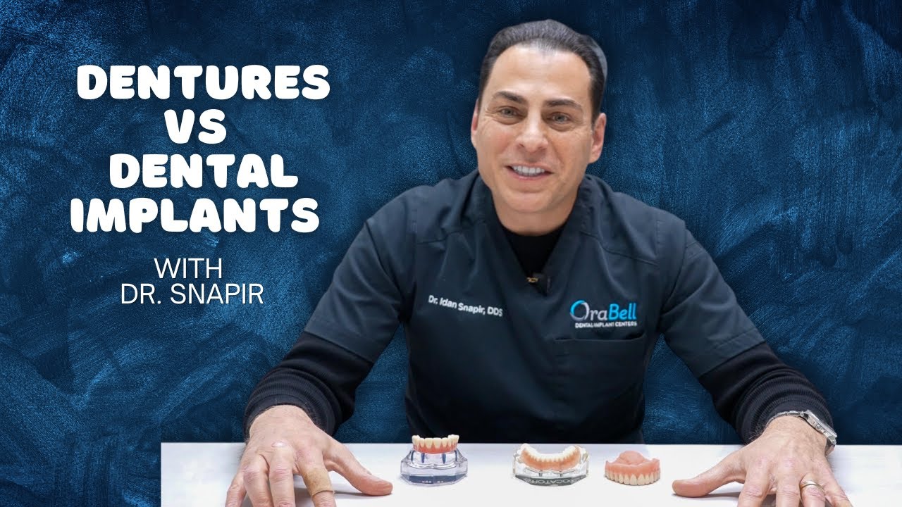 Dentures vs Dental Implants