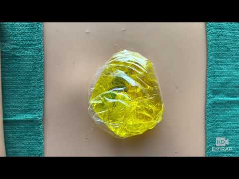 Hernia Reduction Techniques
