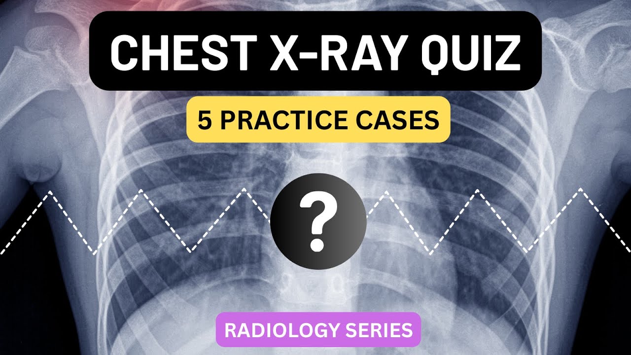 Chest x-ray Interpretation - Med طب