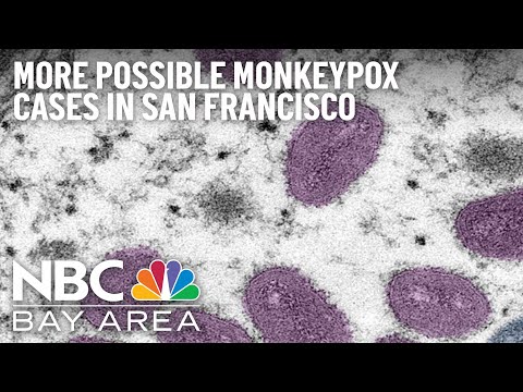 3 New Suspected Monkeypox Cases Reported in SF
