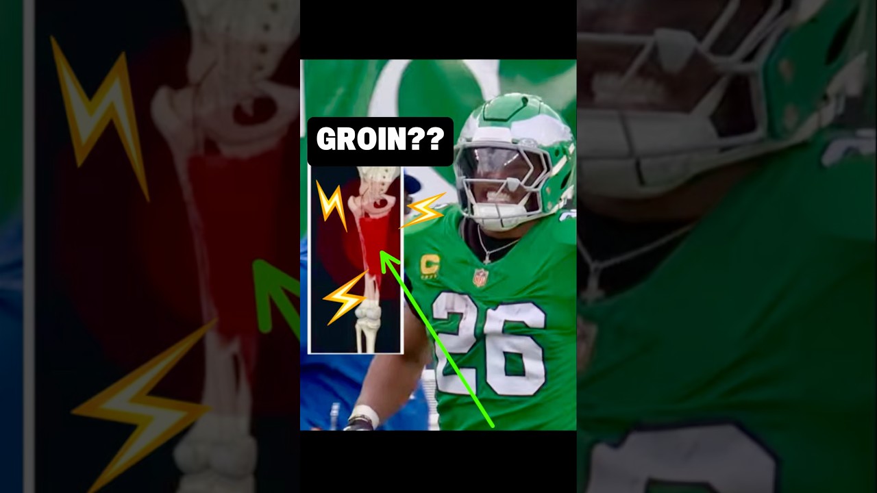 Doctor explains Saquon Groin Injury #Eagles #FantasyFootball #saquonbarkley #injury