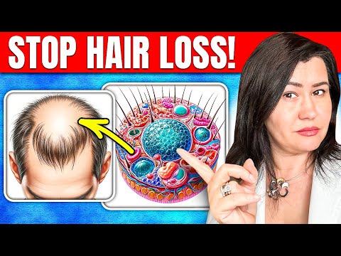 STOP Autoimmune Hair Loss with These 5 Genius Hacks!