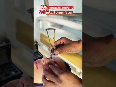 IOP measurement with Schiotz tonometer.