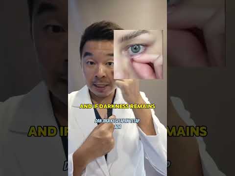 Dark Circles Under Your 👀 Eyes?