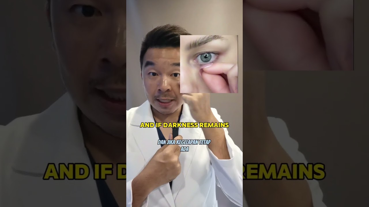 Dark Circles Under Your 👀 Eyes?