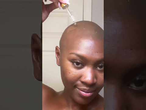 Products For Baldies | SOS Scalp Serum by @baldareco #baldness #baldhead #scalpcare