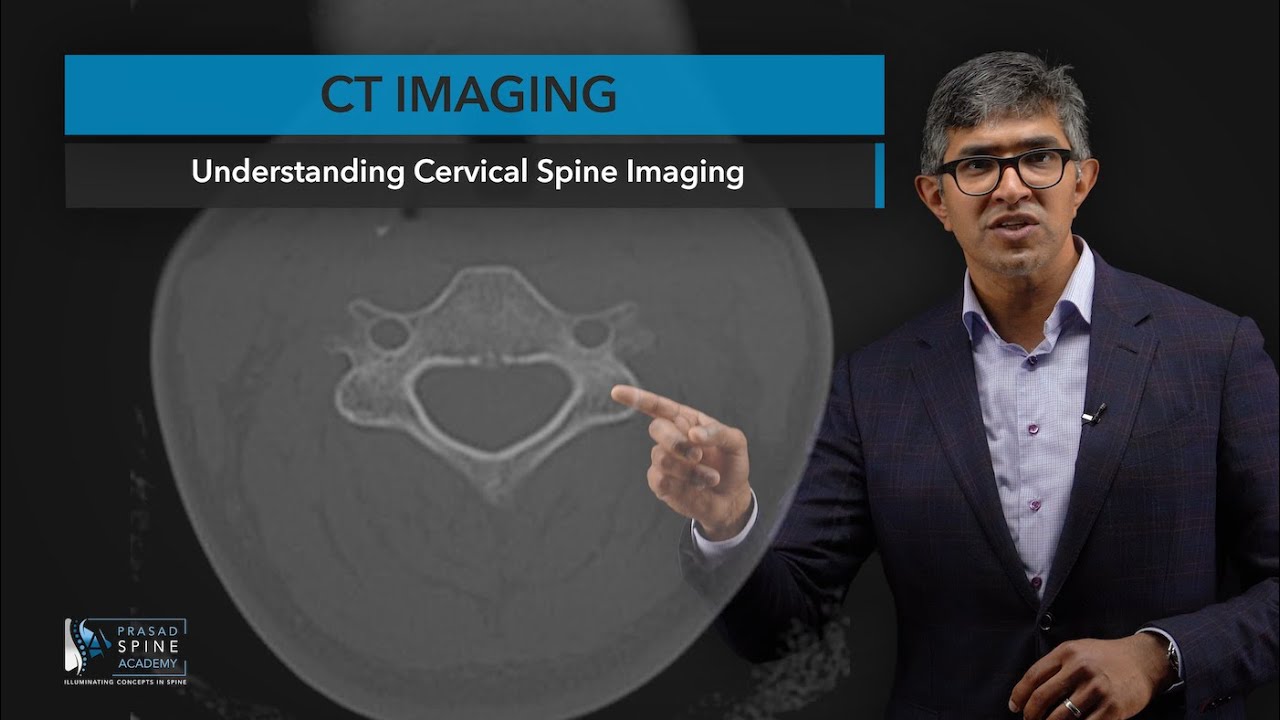Benefits of CT Imaging of The Cervical Spine