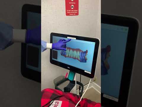 Quintero Orthodontics - 3Shape Technology #shorts