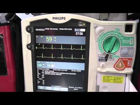 Philips ECG Machine - Latest Price, Dealers & Retailers in India