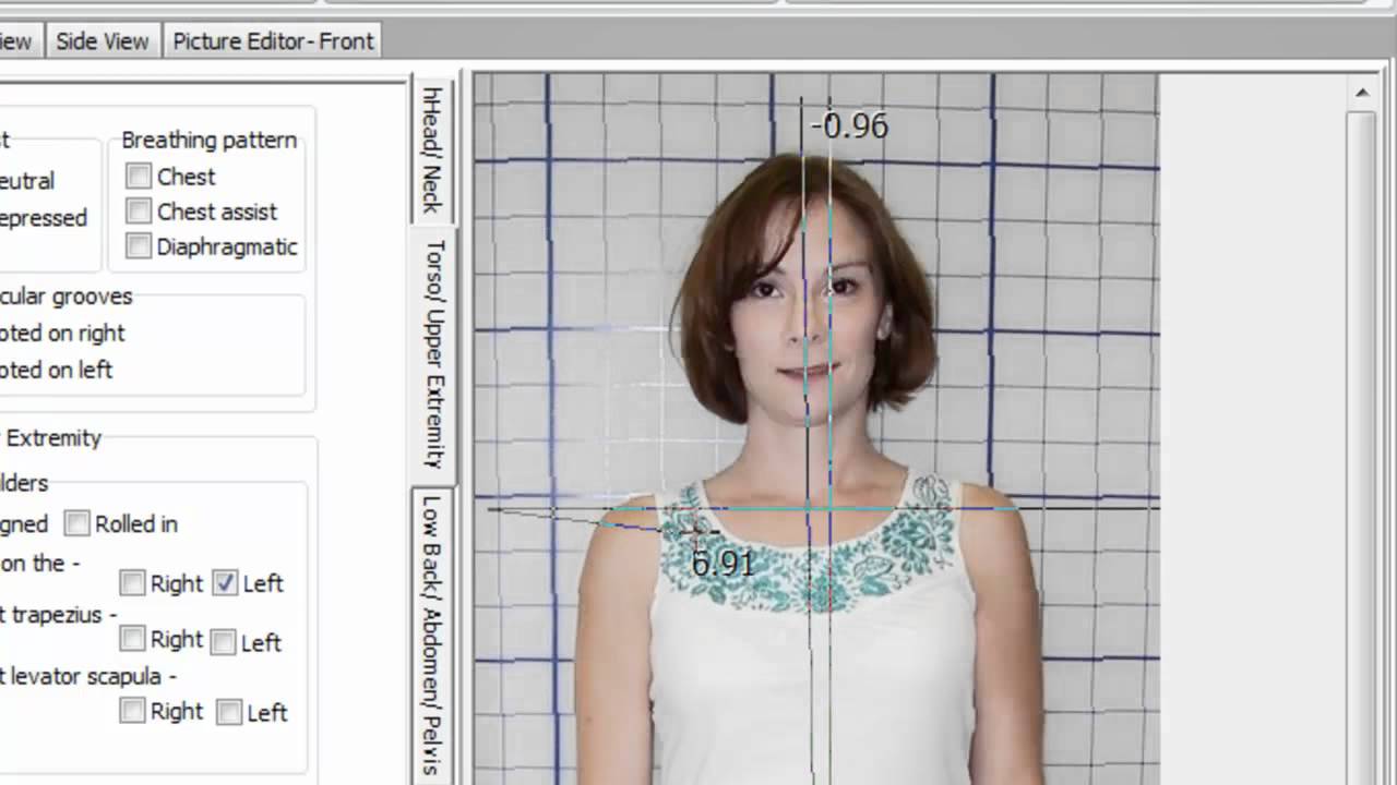 PostureZone Posture Assessment software training.mp4