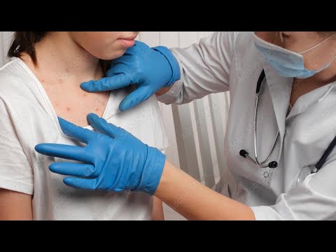 HOW TO CHECK FOR INFECTIONS