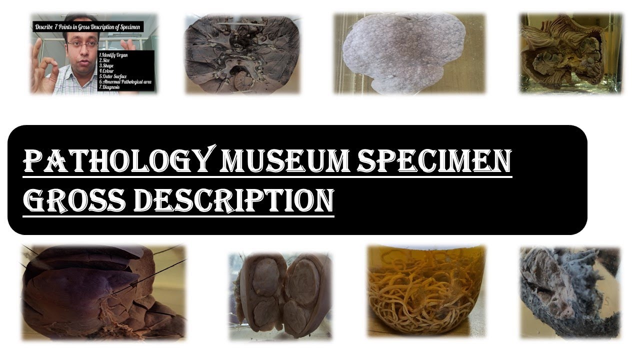 Pathology Museum Specimen Gross Description | Made Easy | Images |