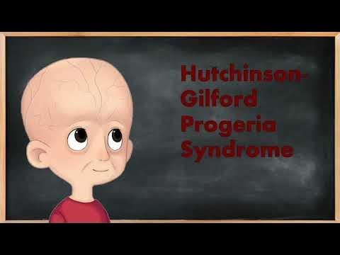 Understanding Hutchinson Gilford Progeria Syndrome