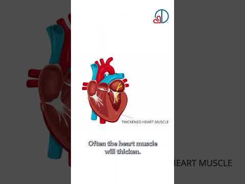 What Is High Blood Pressure? Symptoms, Risks, and How It Affects Your Heart with Richard Kovach, MD