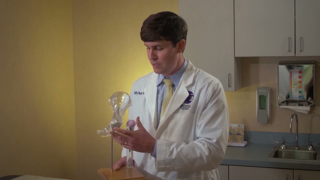 Jeffrey Pearson, MD discusses hip replacement.