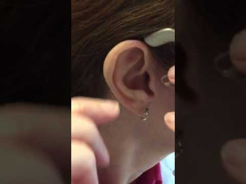 How to insert your hearing device into the ear