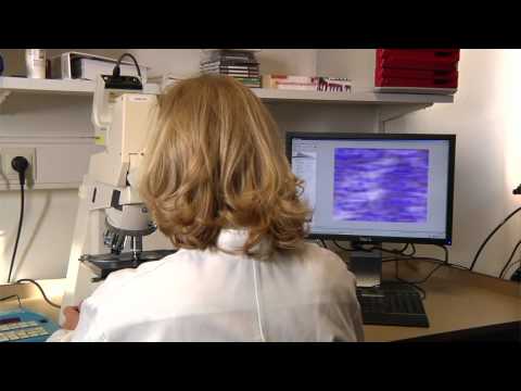 Sysmex - Emergency heart attack — the live-saving discovery of a hidden leukaemia