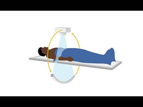 Distinguishing the imaging planes on abdominal CT