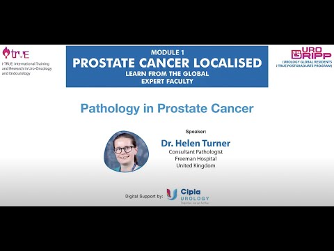 Pathology of Prostate Cancer; Gleason Score Grade Grouping Cribriform pattern; Intraductal carcinoma