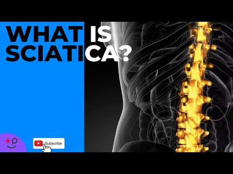 Do you have Sciatica? Learn More About Sciatica from a Spine Surgeon