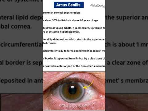 ARCUS SENILIS #shorts#Doctorsahabclinicalscience