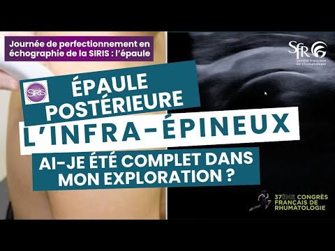 Atelier SIRIS 2024 - L’infra-épineux : ai-je été complet dans mon exploration ?