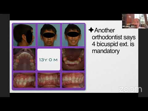 William Hang, DDS, MS Orthodontist and Airway Space Master