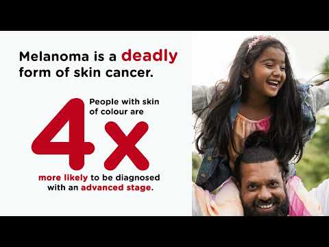 Melanoma Does Not Discriminate - Skin of Colour