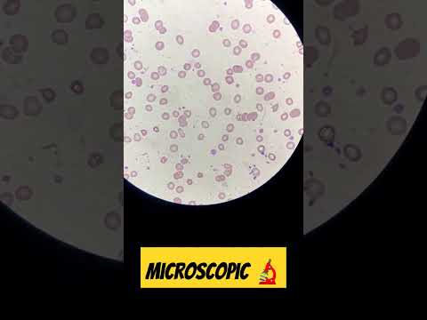Microscopic #lab #medical #pathology #ytshort #youtube #dmlt #viralvideo #bloodtest