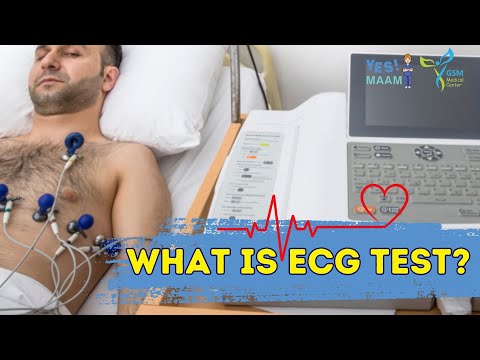 What is ECG test? | #ecg