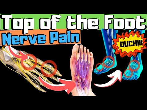 Sharp, Burning, Tingling Top of Foot Pain? [FIX Your Nerve Pain!]