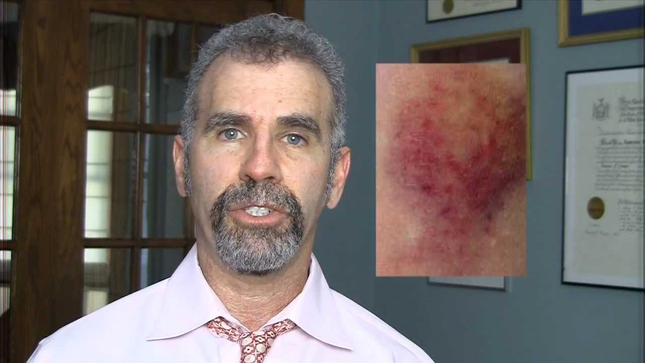 Ithaca Lawyer How to Defend New York Assault in the 3rd Degree