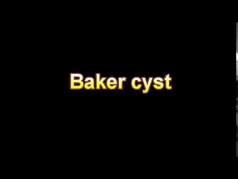What Is The Definition Of Baker cyst Medical Dictionary Free Online