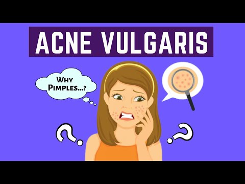 Acne Vulgaris Grade 3 #doctorap #shorts