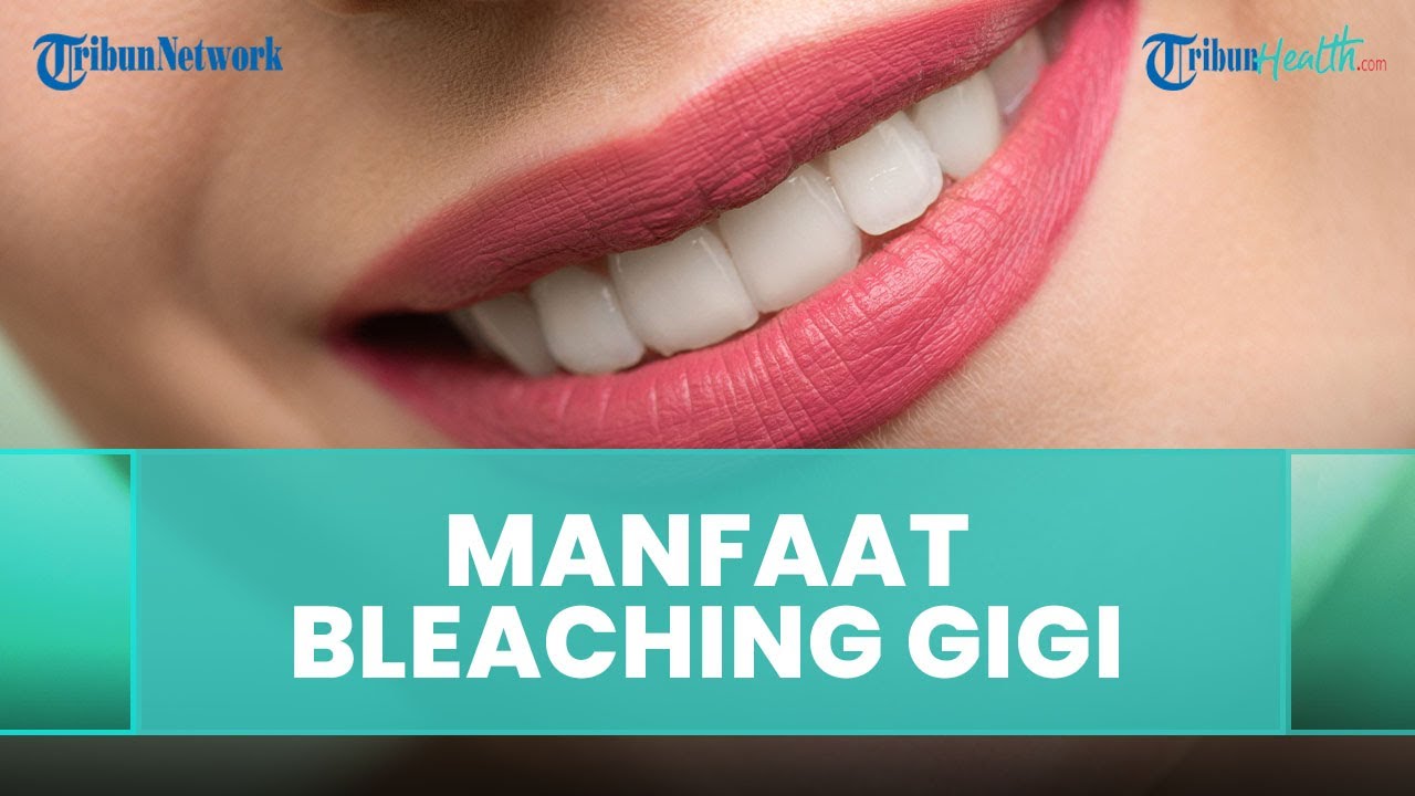 Manfaat Bleaching pada Gigi Itu Apa Dok ? - Tribun Video