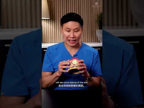 Dr. Thean React: Effects of Isotretinoin on the skin | Ensoul Medical Clinic