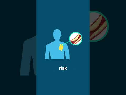 Sleep Deprivation Health Risks! #shorts