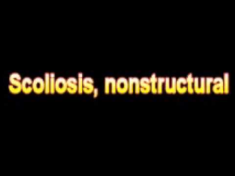 What Is The Definition Of Scoliosis, idiopathic Medical School Terminology Dictionary